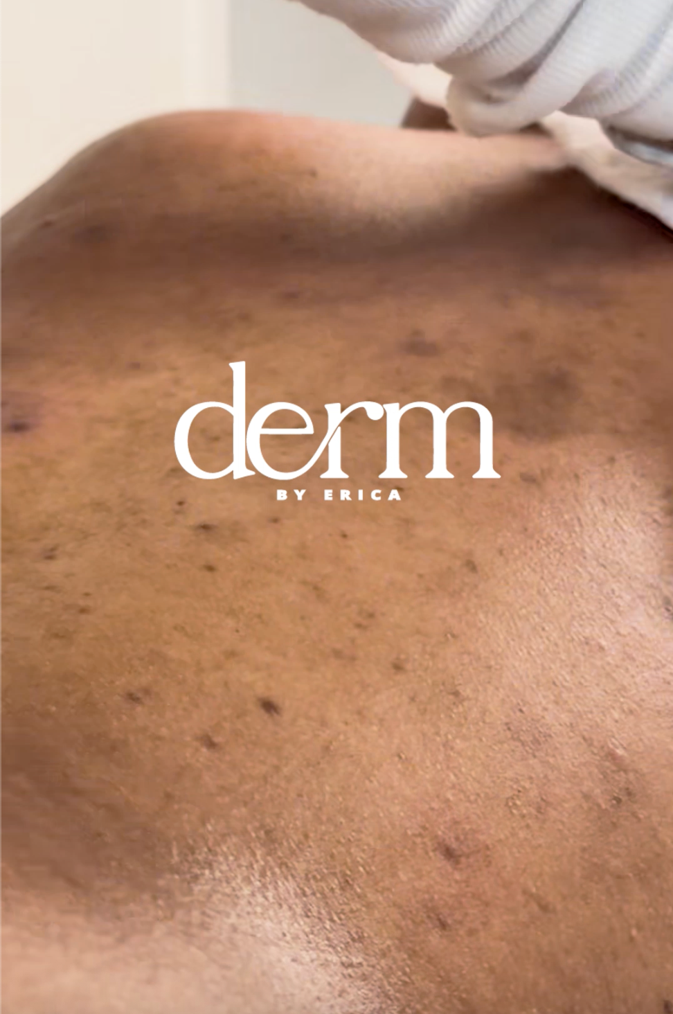 The Ultimate Guide to Layering Your Skincare for a Radiant Glow – Derm ...