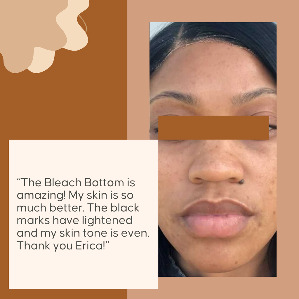 Bleach Bottom Cream – Derm By Erica